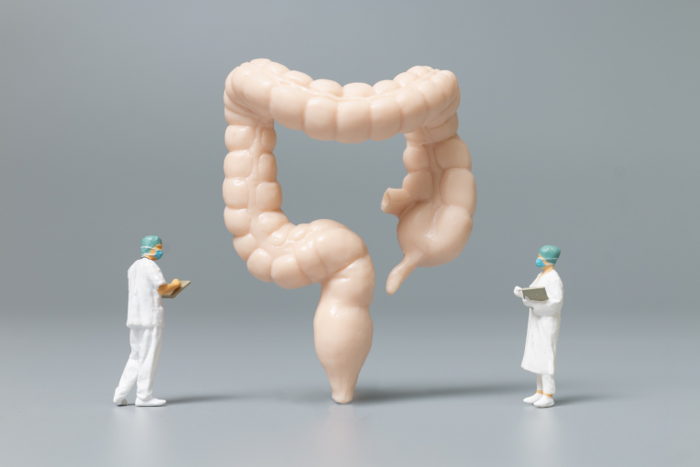 Ulcerative Proctitis Vs Colitis: Symptoms, Causes, And Key Differences