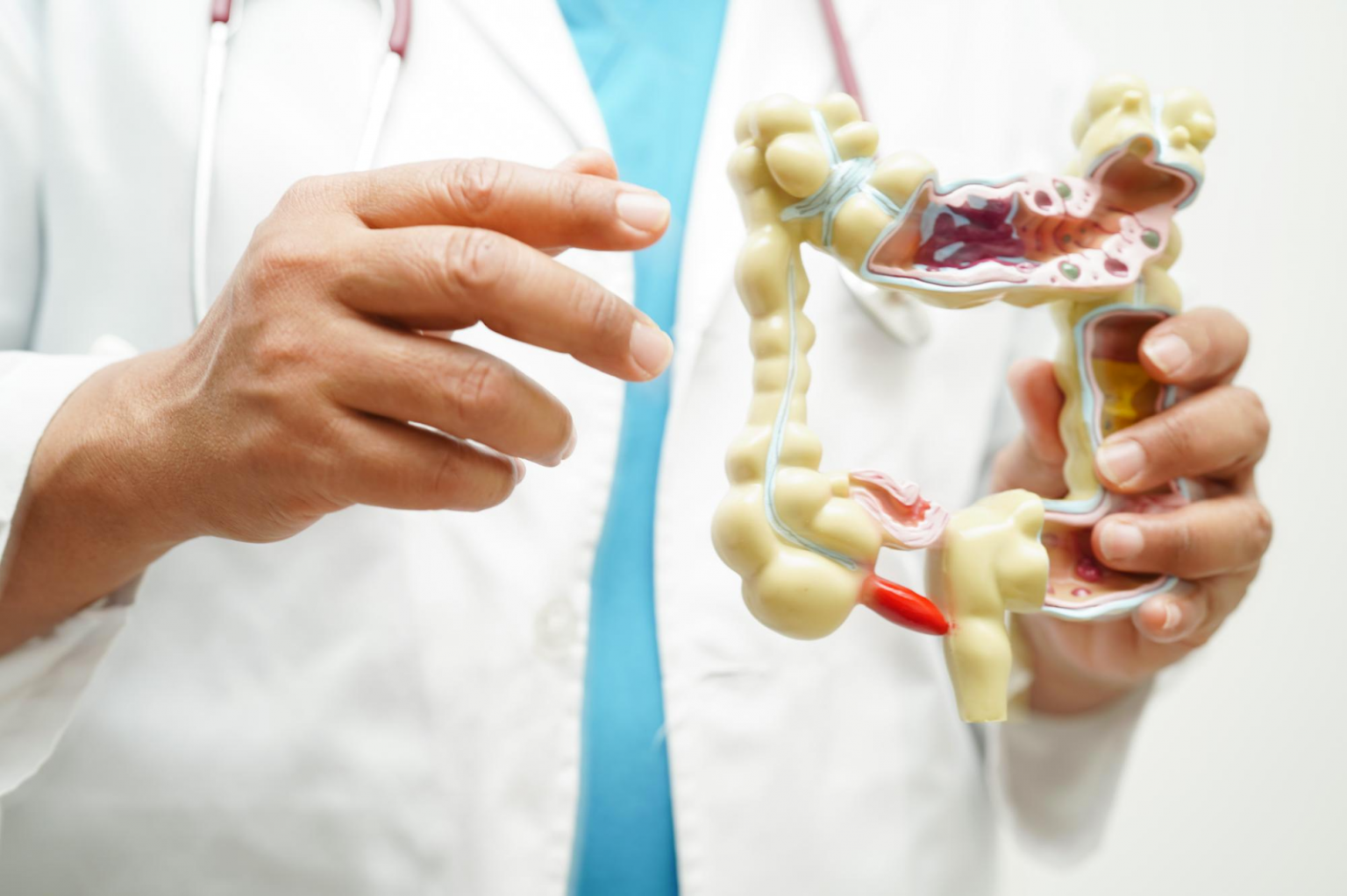 Infectious Colitis: Symptoms, Causes, and Treatment Strategies