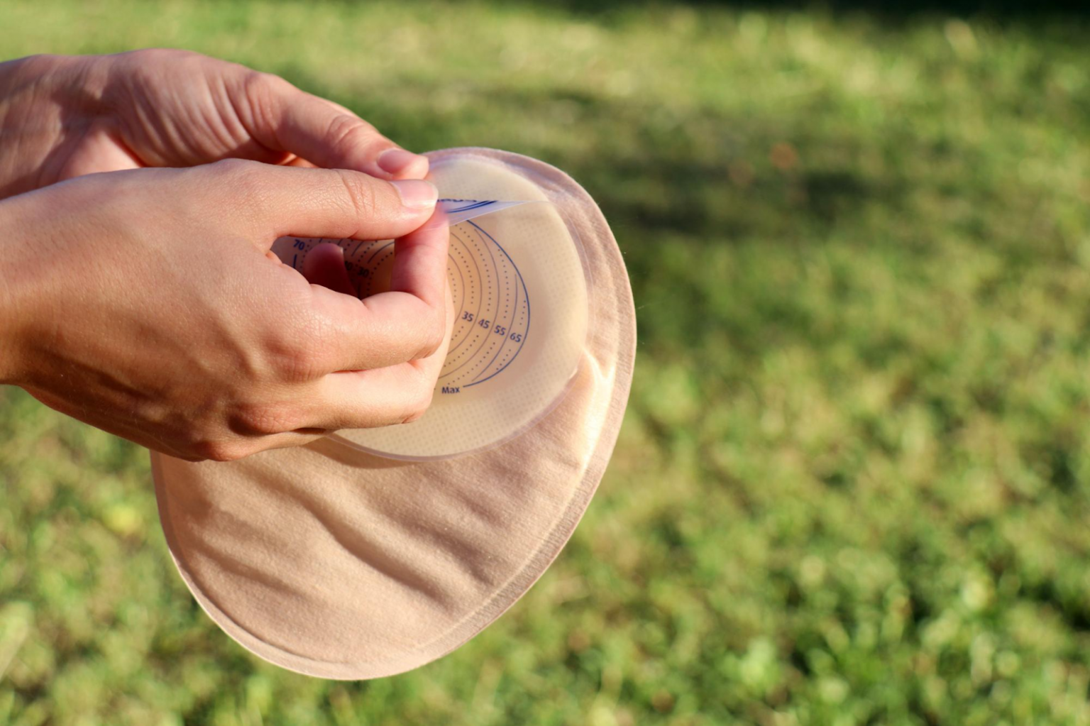 Ostomy Bag Vs Colostomy Bag: 3 Differences And Essential Tips